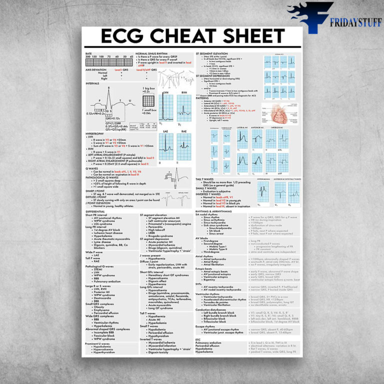 Ecg Cheat Sheet Knowledge Canvas, Poster - FridayStuff